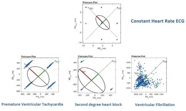HeartyPatch – Open source ECG patch with Wifi